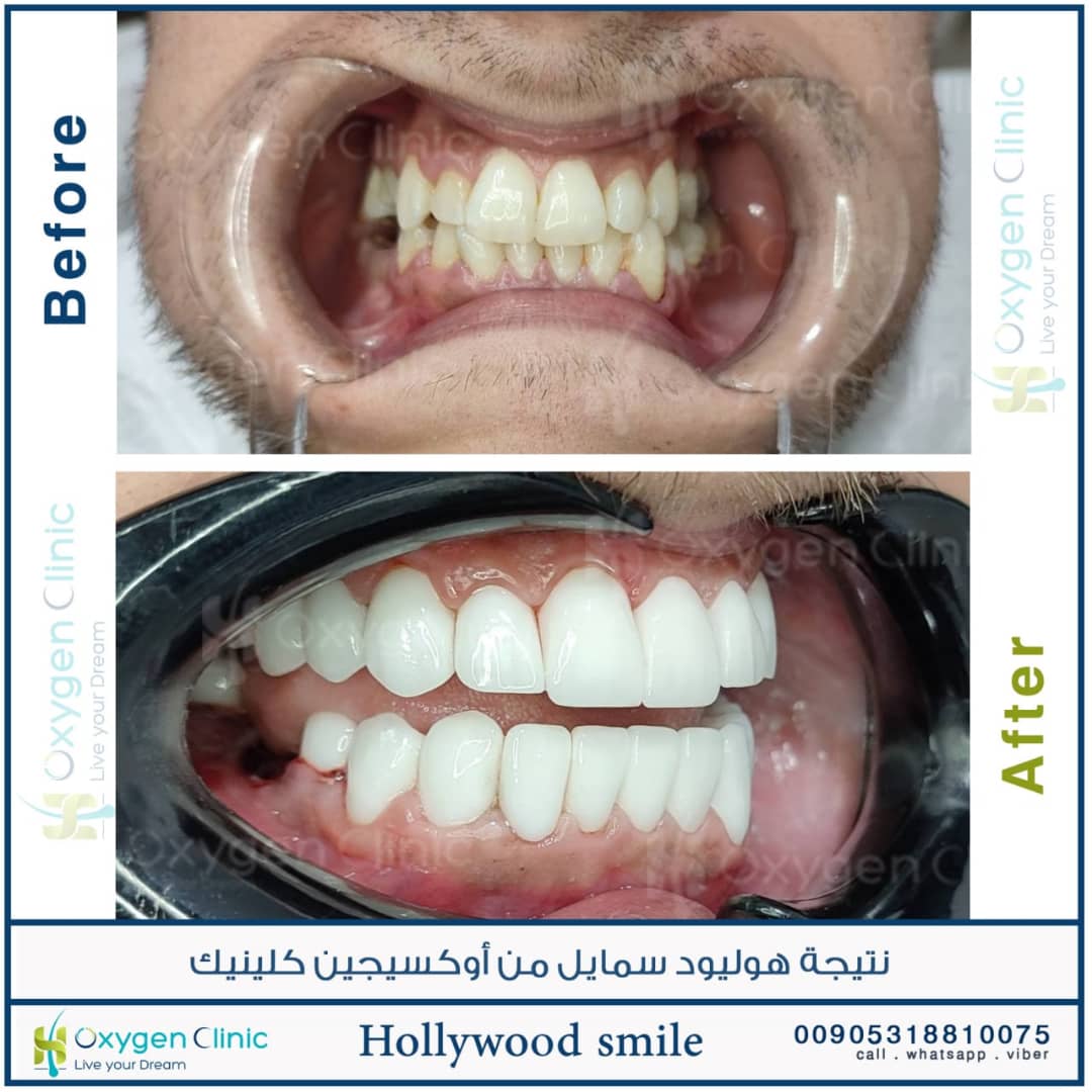 Oxygen Clinic is a medical and cosmetic | Oxygen Clinic